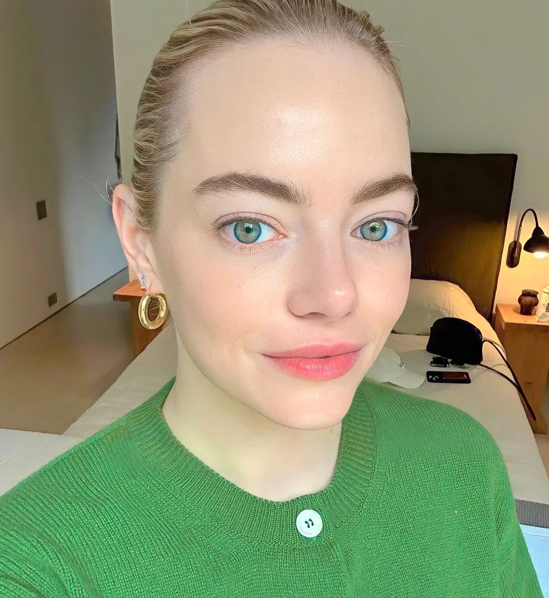 Emma Stone Bio, Age, Career, Net Worth, Husband, Height,