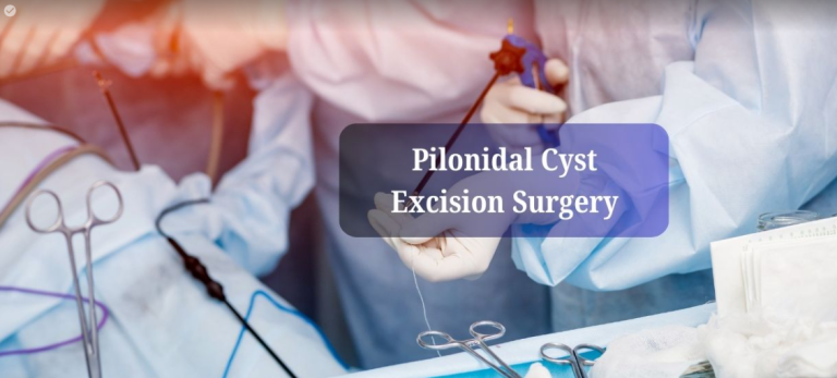 Early Detection and Treatment of Pilonidal Cyst Eliminates Risks of ...